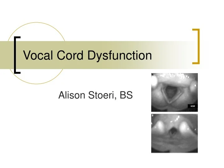 PPT - Vocal Cord Dysfunction PowerPoint Presentation, free download ...