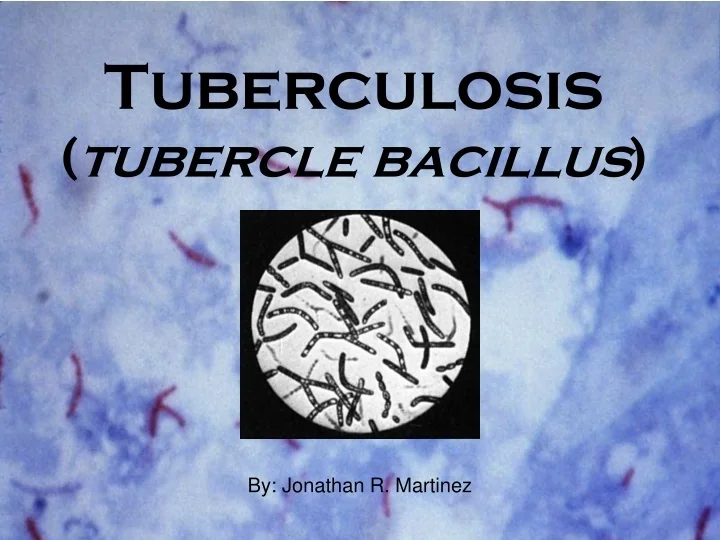 PPT - Tuberculosis ( tubercle bacillus ) PowerPoint Presentation, free ...