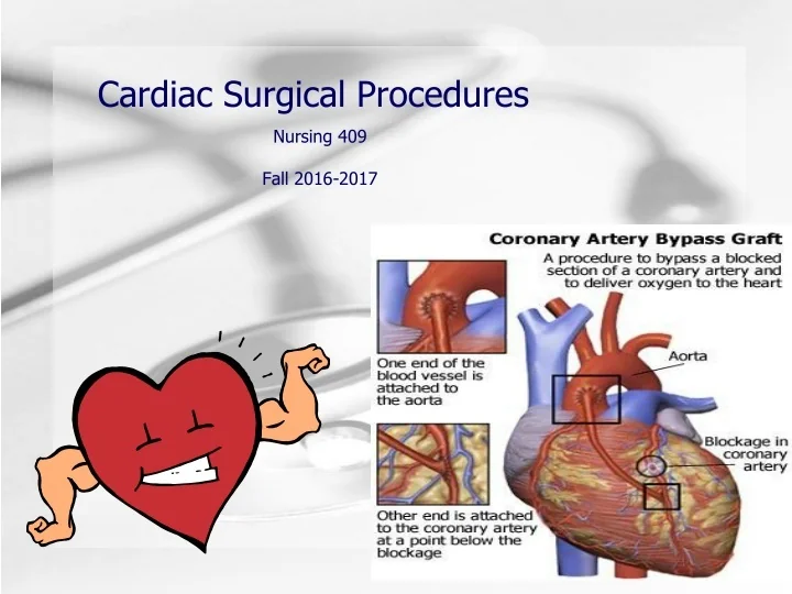 PPT - Cardiac Surgical Procedures PowerPoint Presentation, free ...