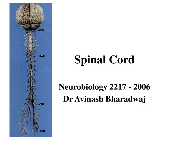 PPT - Spinal Cord PowerPoint Presentation, free download - ID:9384158