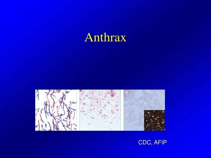 PPT - Anthrax PowerPoint Presentation, free download - ID:9426561