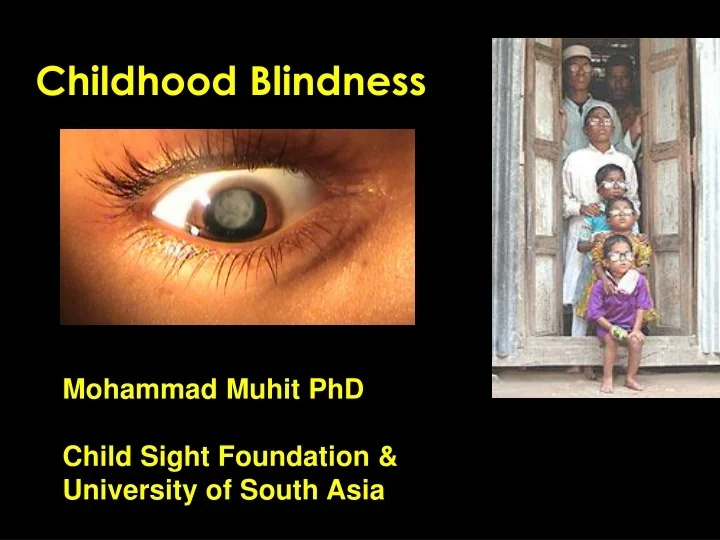 PPT - Childhood Blindness PowerPoint Presentation, free download - ID ...
