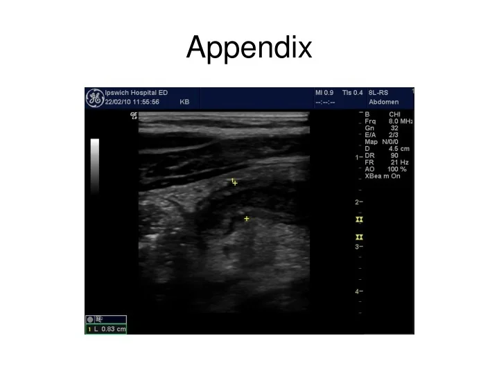 PPT - Appendix PowerPoint Presentation, free download - ID:9459546