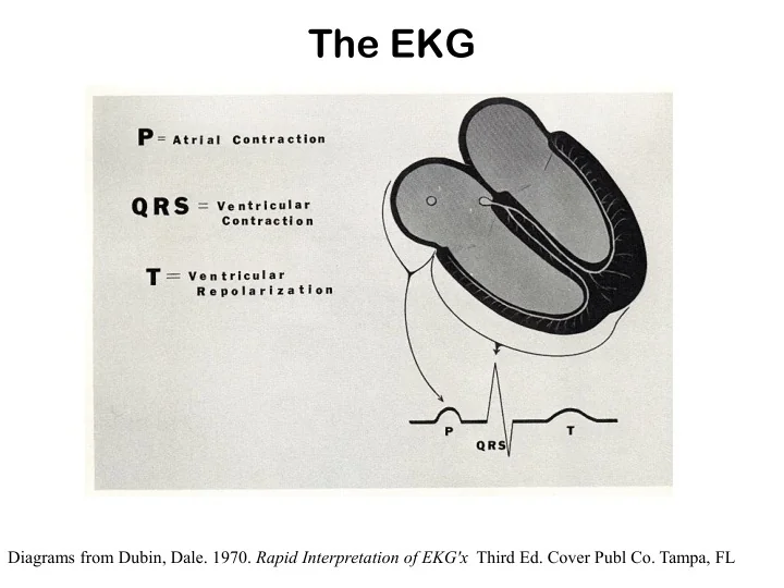 PPT - The EKG PowerPoint Presentation, free download - ID:9472696