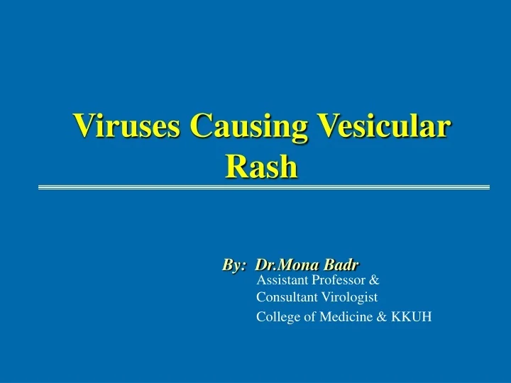 PPT - Viruses Causing Vesicular Rash PowerPoint Presentation, free ...
