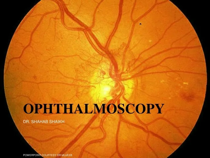 PPT - OPHTHALMOSCOPY PowerPoint Presentation, free download - ID:9482006