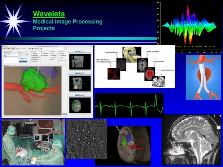 PPT - Wavelets Medical Image Processing Projects PowerPoint ...