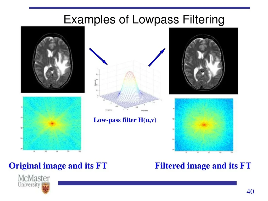 PPT ENG4BF3 Medical Image Processing PowerPoint Presentation Free
