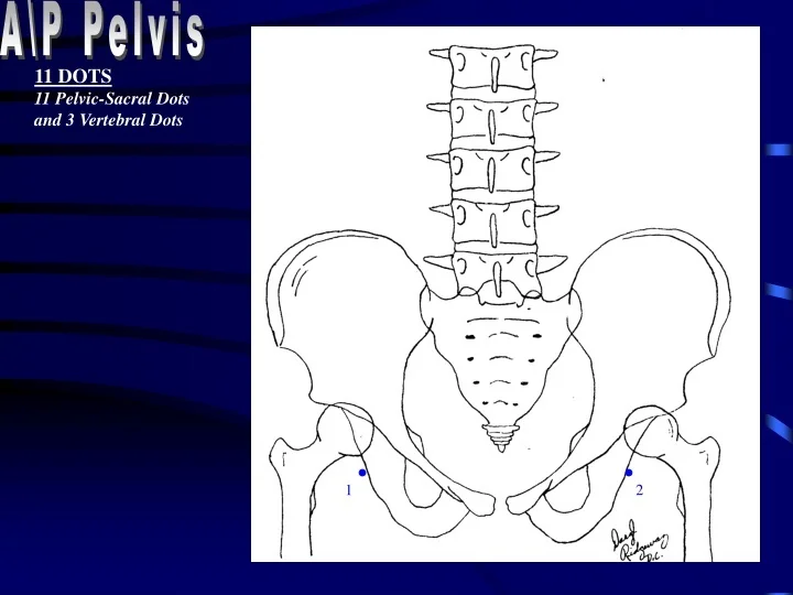 PPT - A\P Pelvis PowerPoint Presentation, free download - ID:9597574