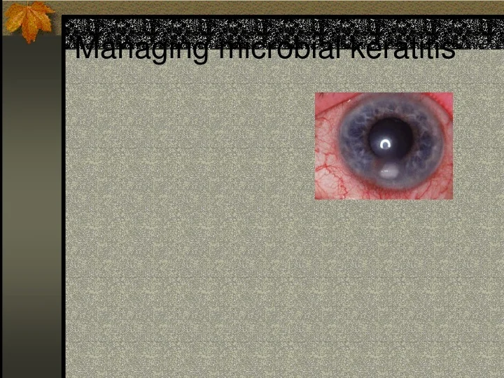 PPT - Managing microbial keratitis PowerPoint Presentation, free download - ID:9604673