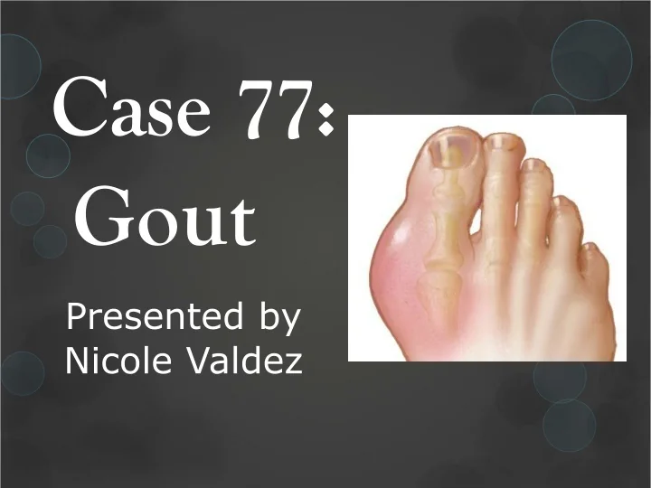 PPT - Case 77: Gout PowerPoint Presentation, free download - ID:9628891