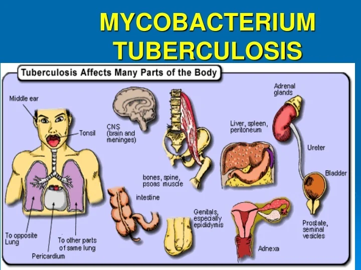 PPT - MYCOBACTERIUM TUBERCULOSIS PowerPoint Presentation, free download ...