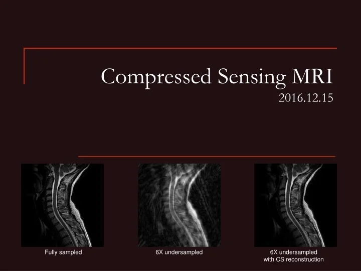 PPT - Compressed Sensing MRI 2016.12.15 PowerPoint Presentation, free ...