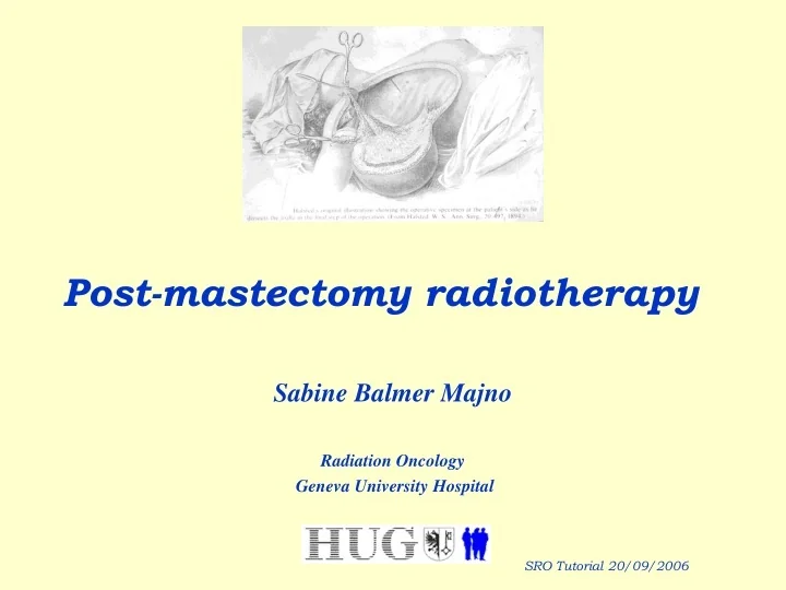 PPT - Post-mastectomy radiotherapy PowerPoint Presentation, free ...