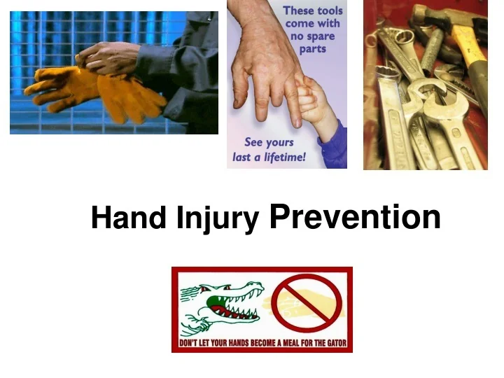PPT - Hand Injury Prevention PowerPoint Presentation, free download ...