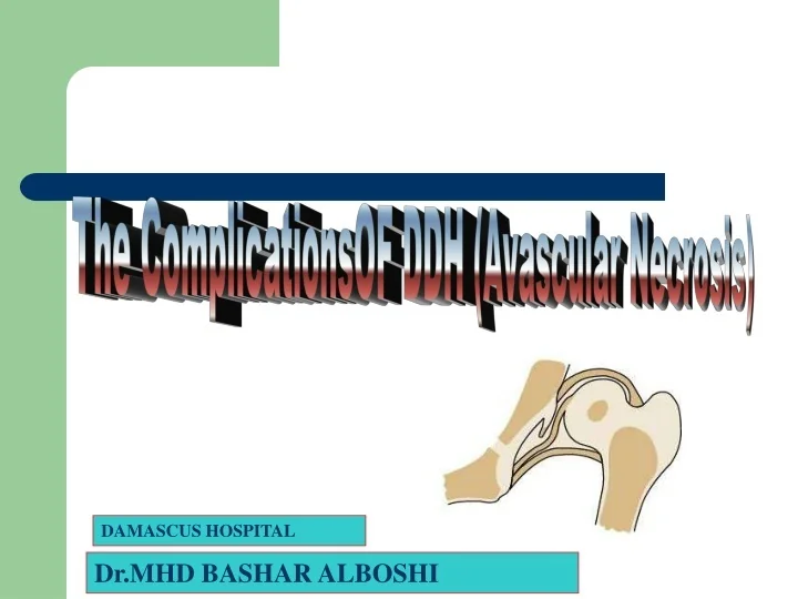 PPT - The ComplicationsOF DDH (Avascular Necrosis) PowerPoint ...
