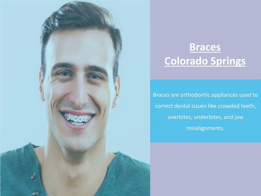 PPT - Clear Braces Colorado Springs | Orthodontic Experts of Colorado ...