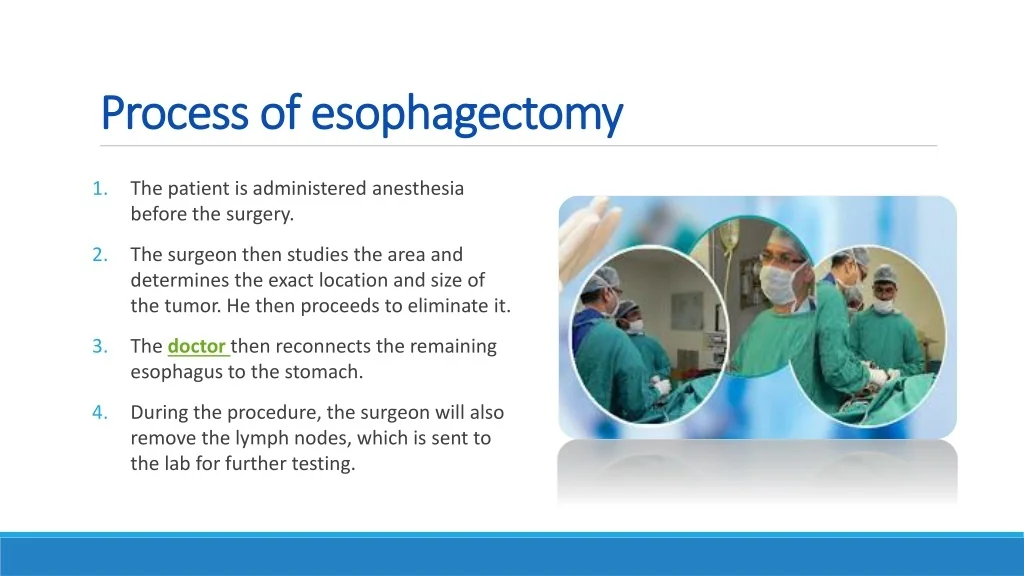 PPT - What is Esophagectomy |Best Cancer and Bariatric Surgeon in ...