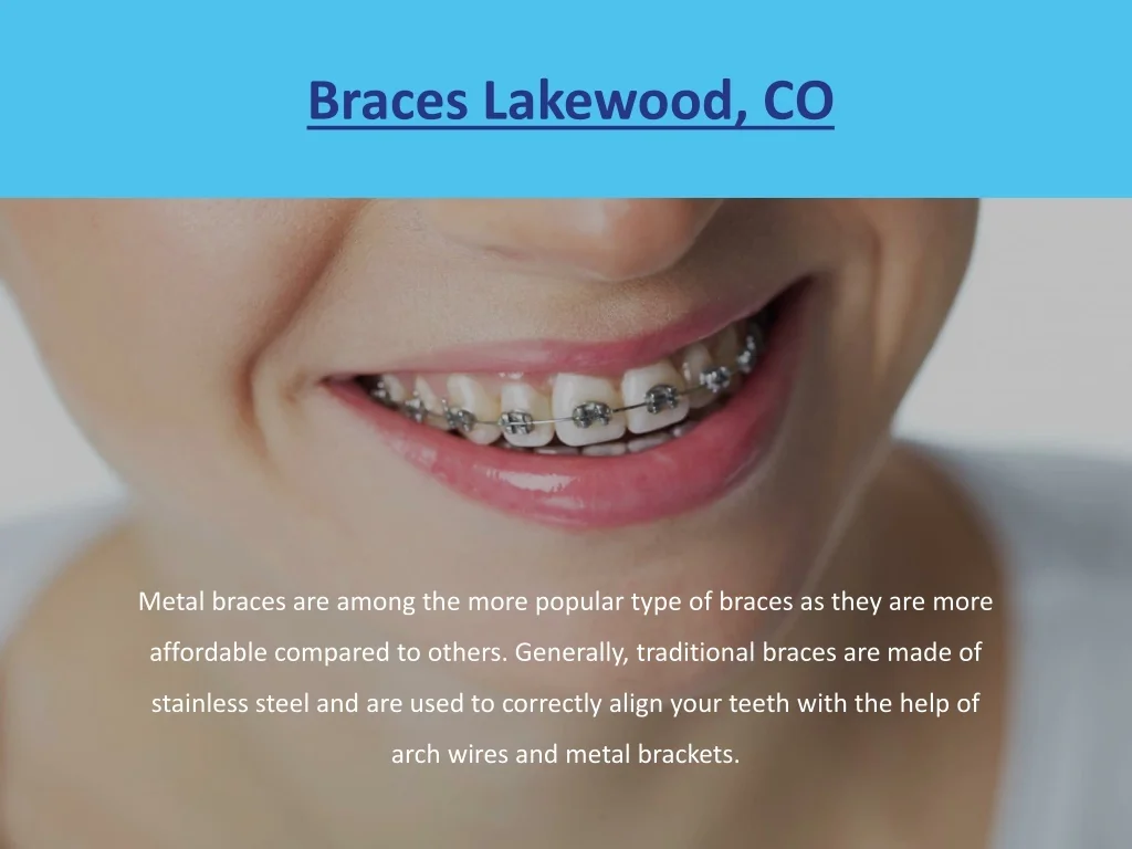 PPT - Best Braces in Lakewood, CO | Orthodontic Experts of Colorado ...